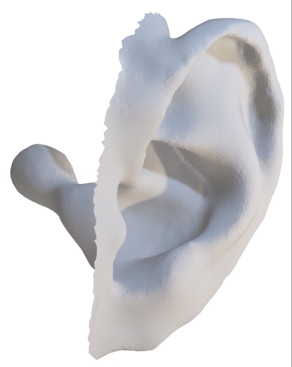 3D Ear Scans - FDA-Approved Perfect Fit Solutions